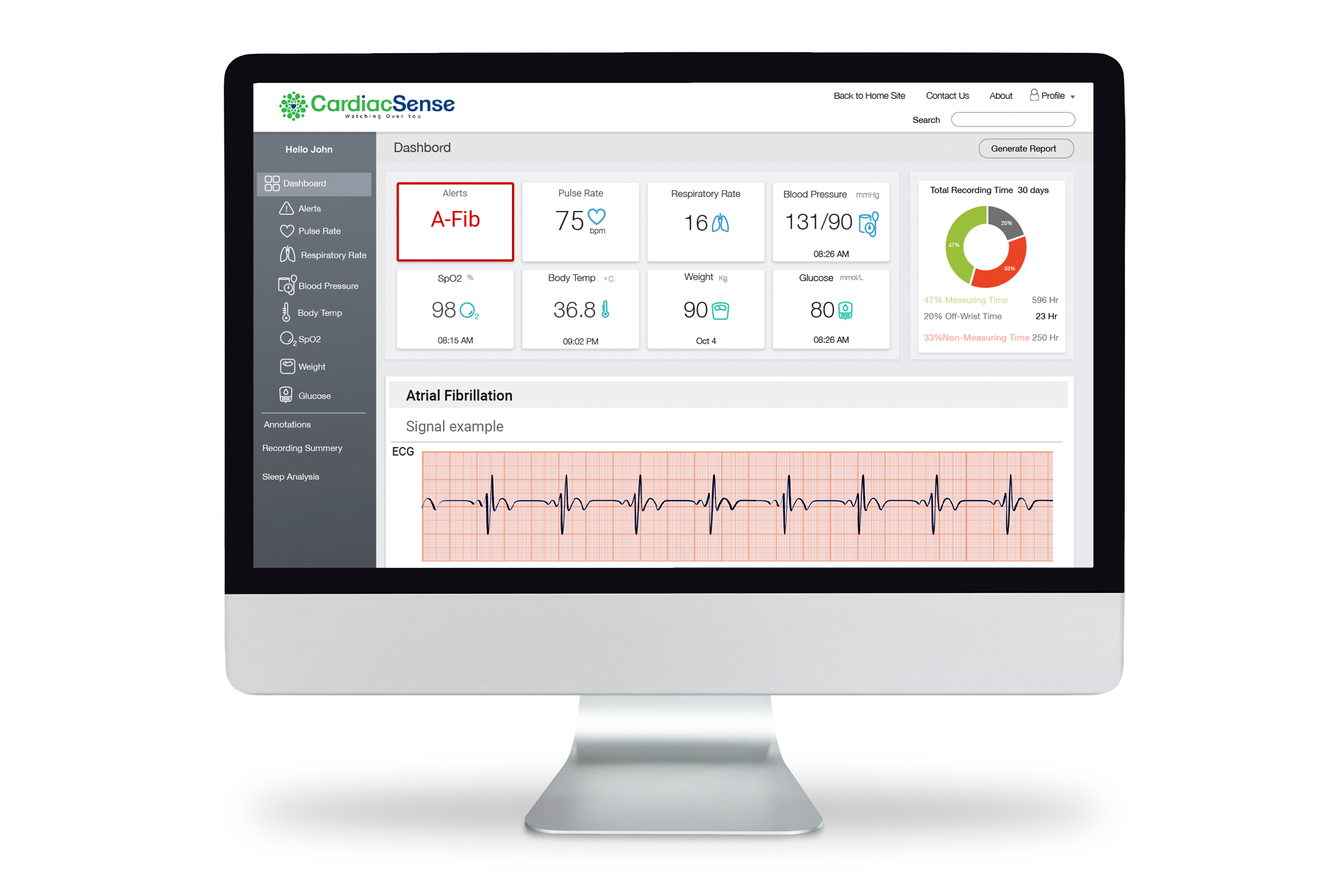 Atrial Fibrillation - CardiacSense